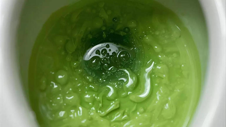 Why is your poop green: Common causes, studies, and when to worry