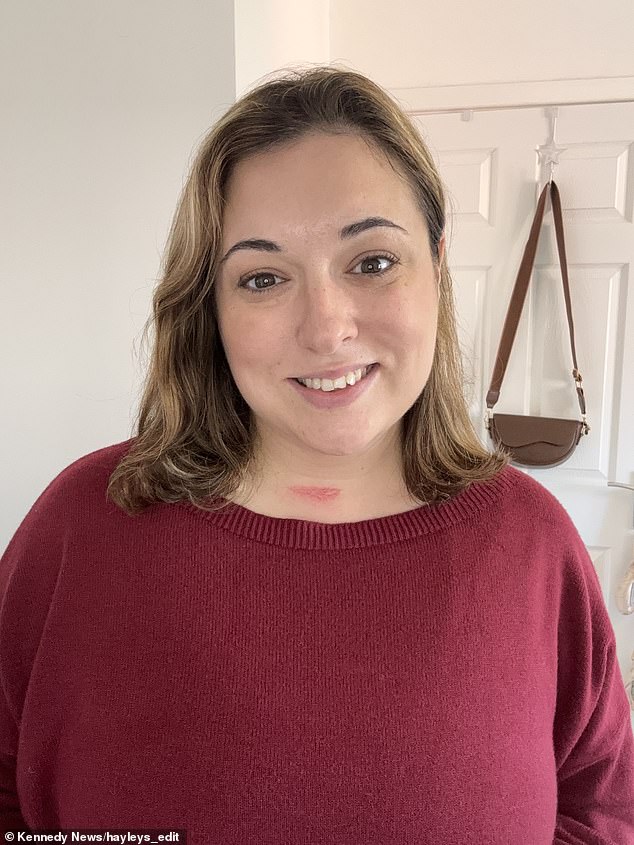 Mother-of-two left with a broken neck after huge YAWN: 'I had a 50/50 ...