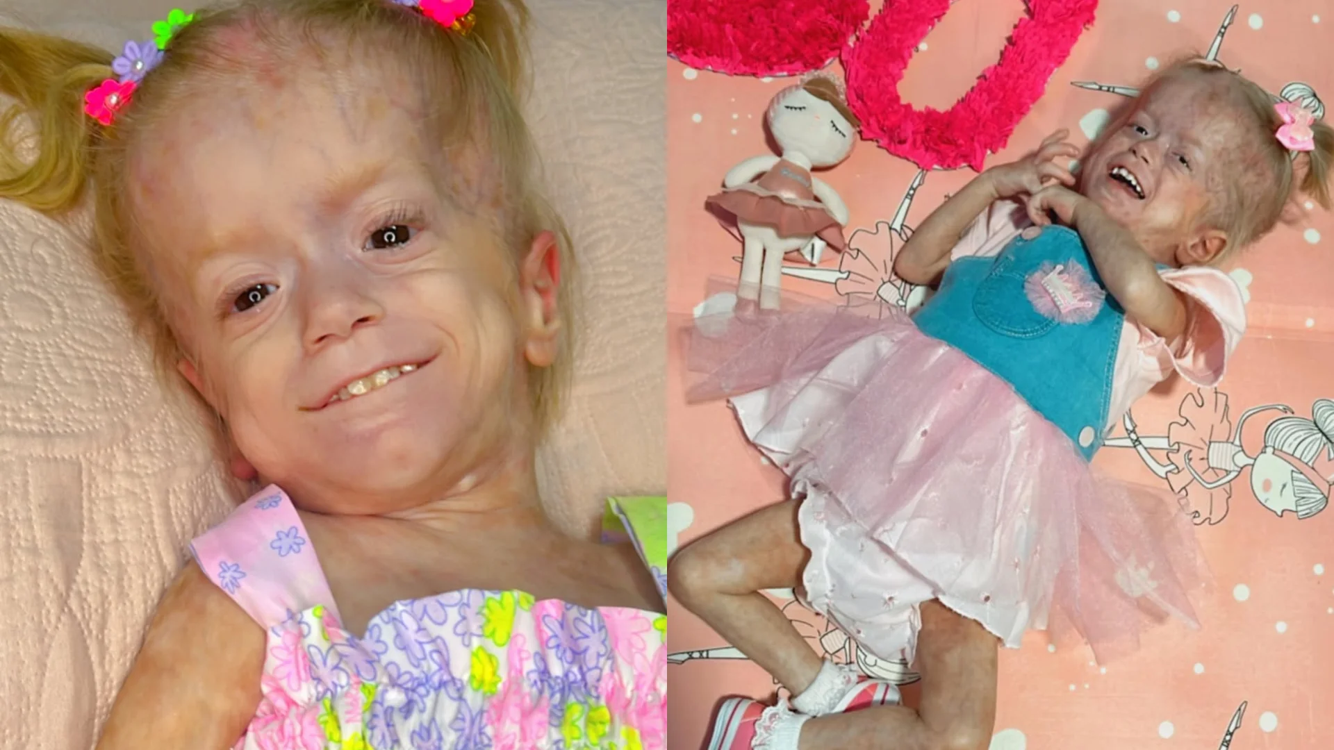 Mãe relata luta e preconceito pela filha com doenças raras: “Por que ...