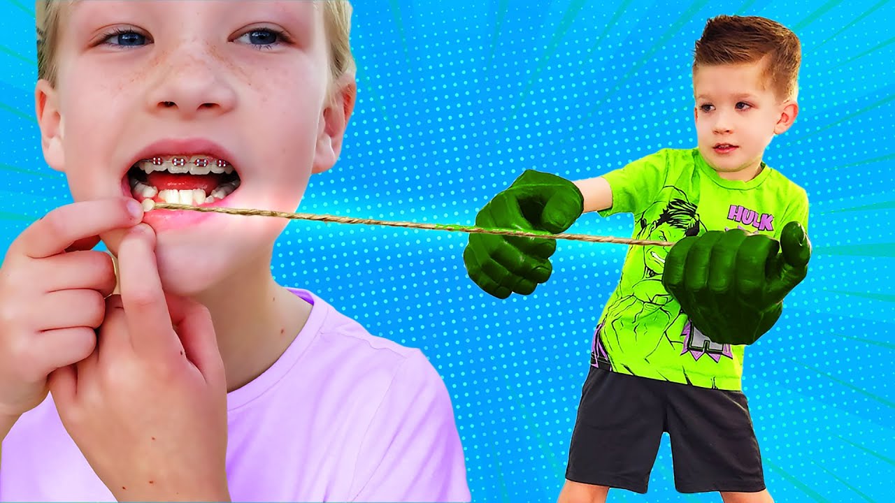 Madison’s tooth gone? What happened?