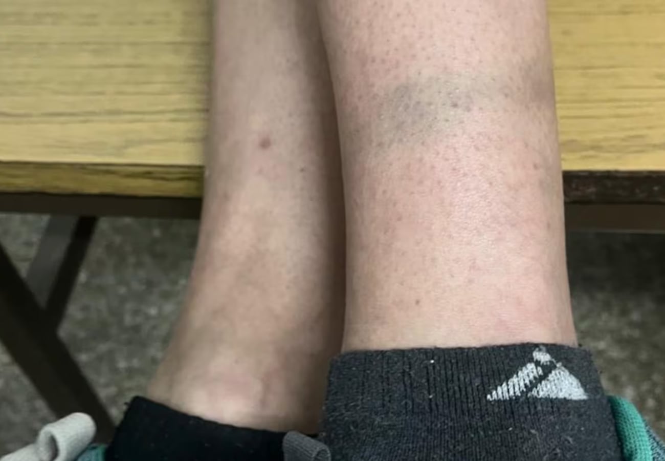 Córdoba La Secuestraron Y Escapó Cuando Sus Captores Se Durmieron