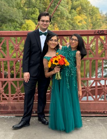Conjoined Twin Carmen Andrade Celebrates 1st Wedding Anniversary with ...