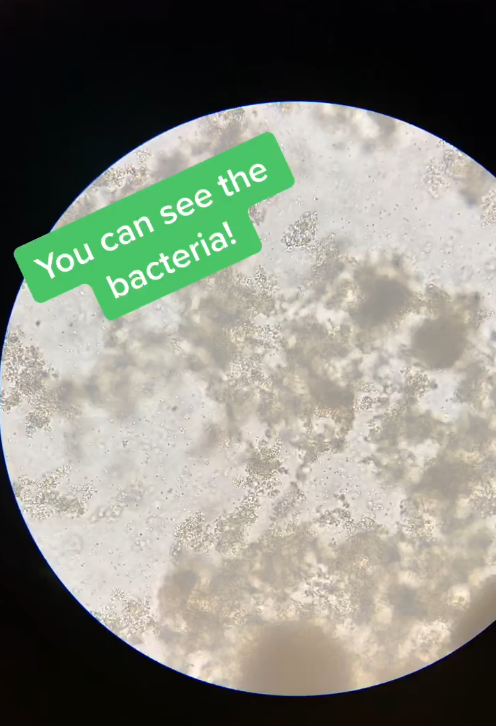 What’s Really Inside Your Yogurt Under the Microscope