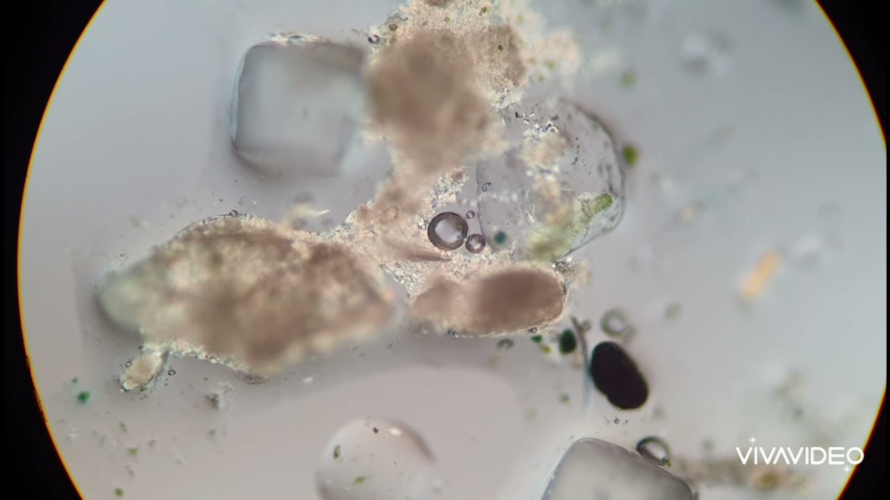 Sea Monkeys Under the Microscope