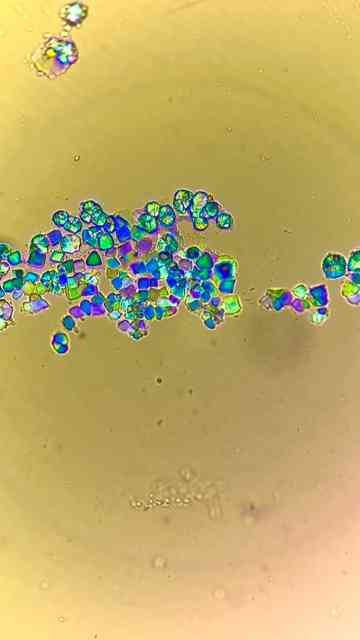 Hotel Shower Drain Water Under The Microscope! Oof!