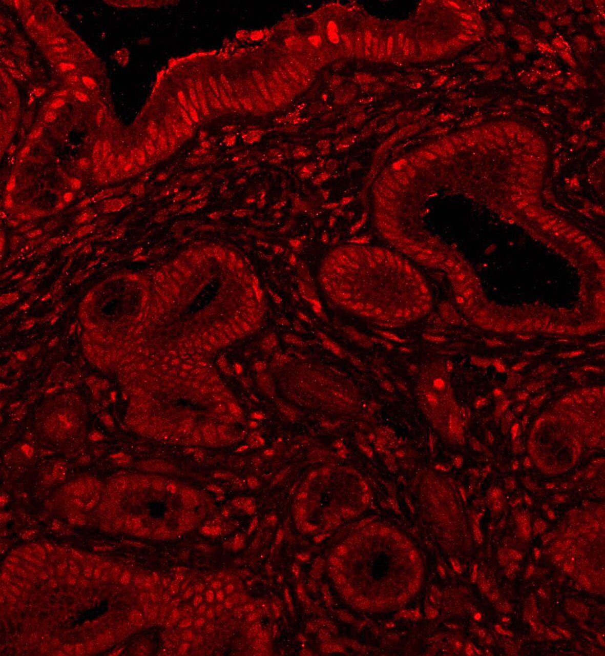 Starve tumors? How to kill cancer by cutting off its energy supply