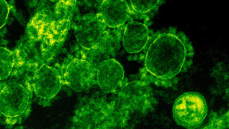 Scientists uncover bacteria surviving in space vacuum