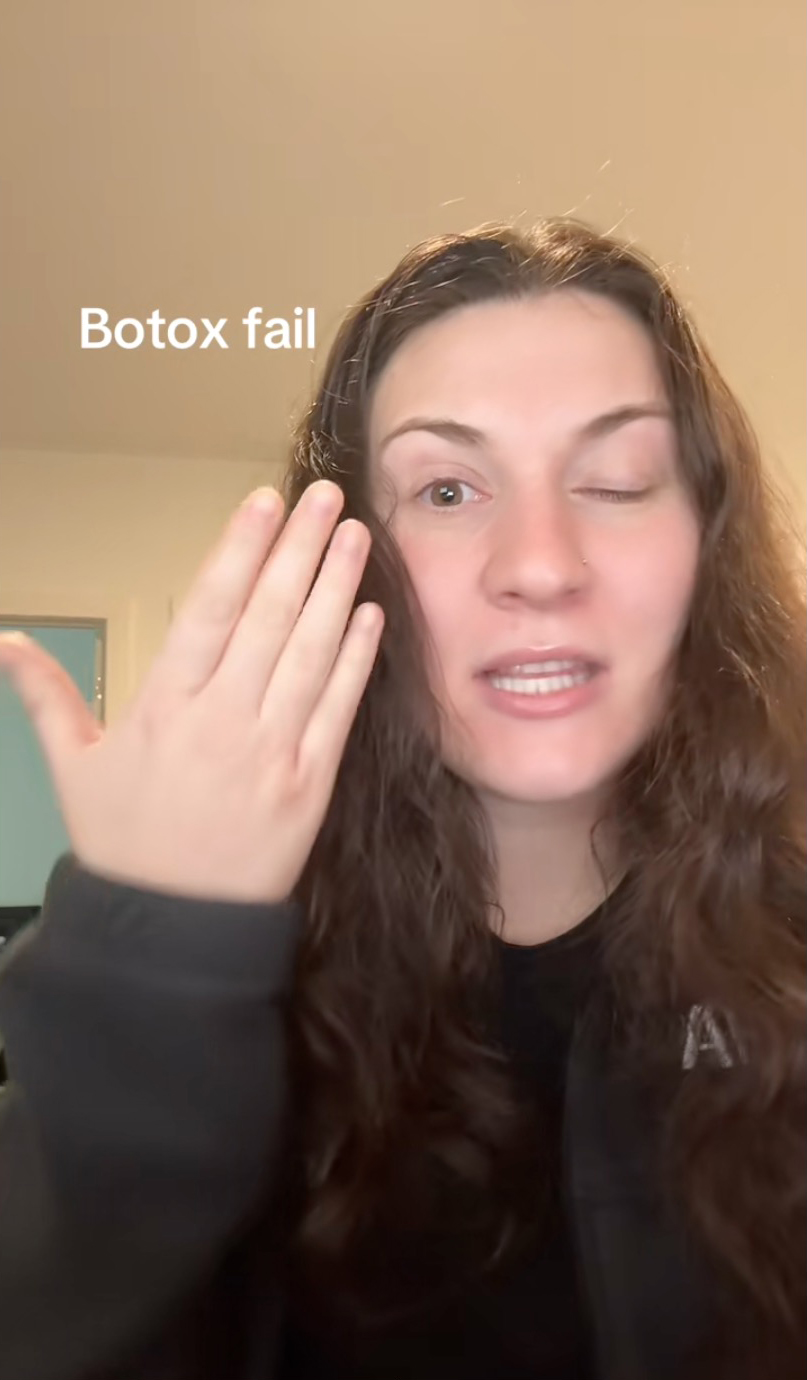 Stunned patient shares terrifying Botox experience that left her scarred