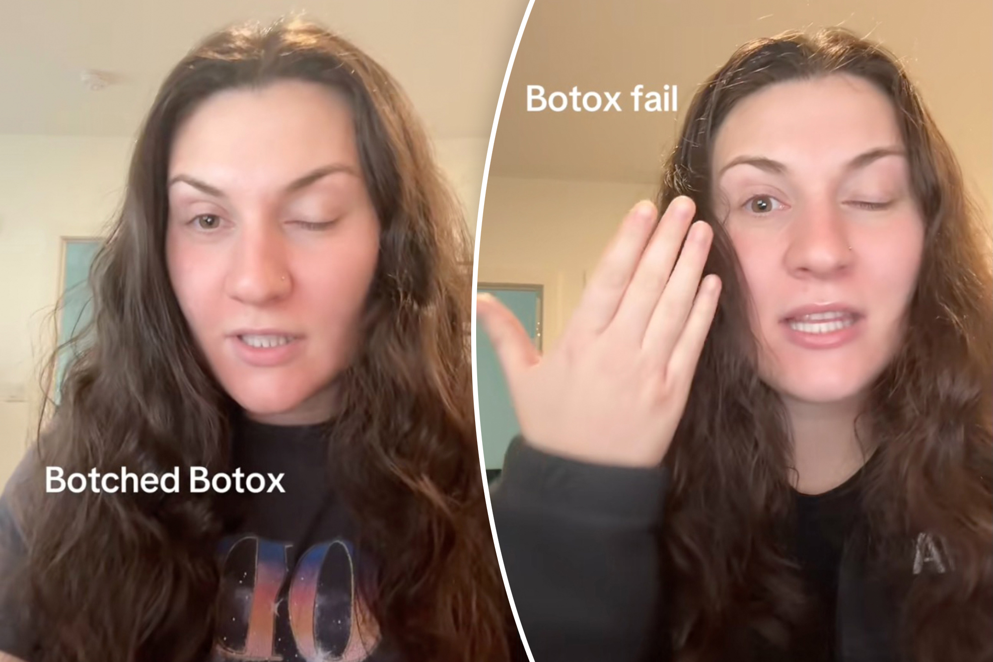 Stunned patient shares terrifying Botox experience that left her scarred
