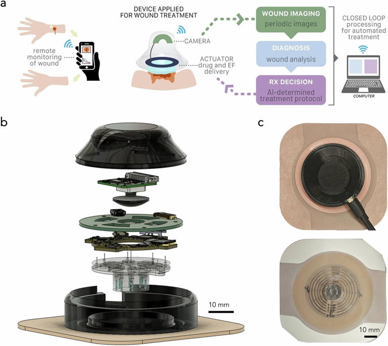 Smart device uses AI and bioelectronics to speed up wound healing process
