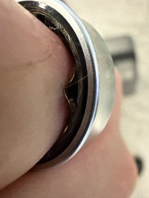 Samsung Galaxy Ring Swollen Battery Incident Sends User to Hospital