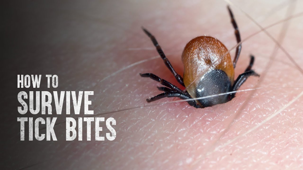 Tick Bite Survival Guide