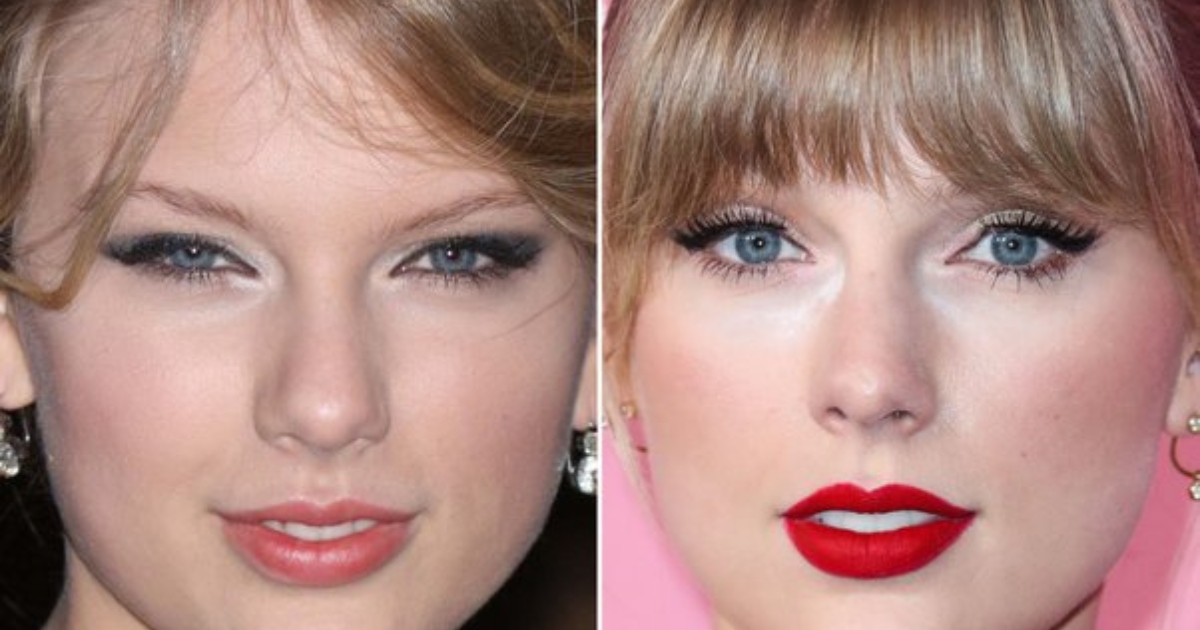Taylor Swift’s Before-and-After Pics Spark Plastic Surgery Rumors ...