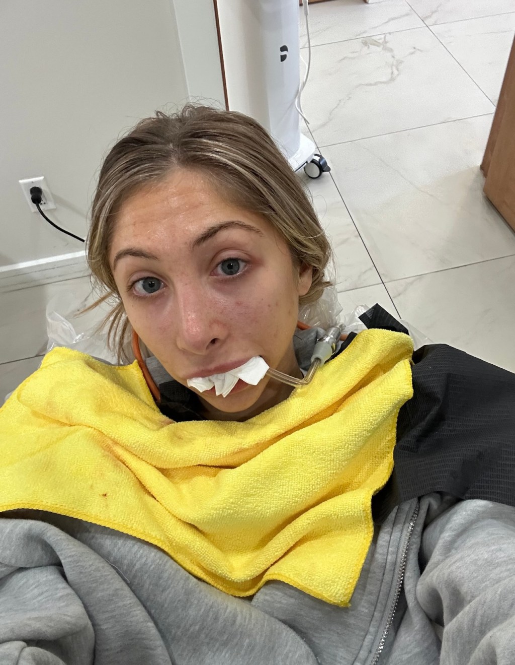 Celebs made veneers a popular post-pandemic cosmetic quick fix — but ...