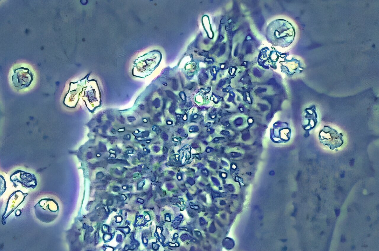 Egg yolk proves key to establishing authentic embryonic stem cells from ...