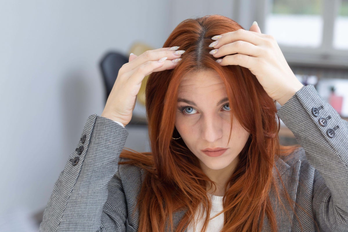 I’m a trichologist. This is how you can thicken your hair without hormones