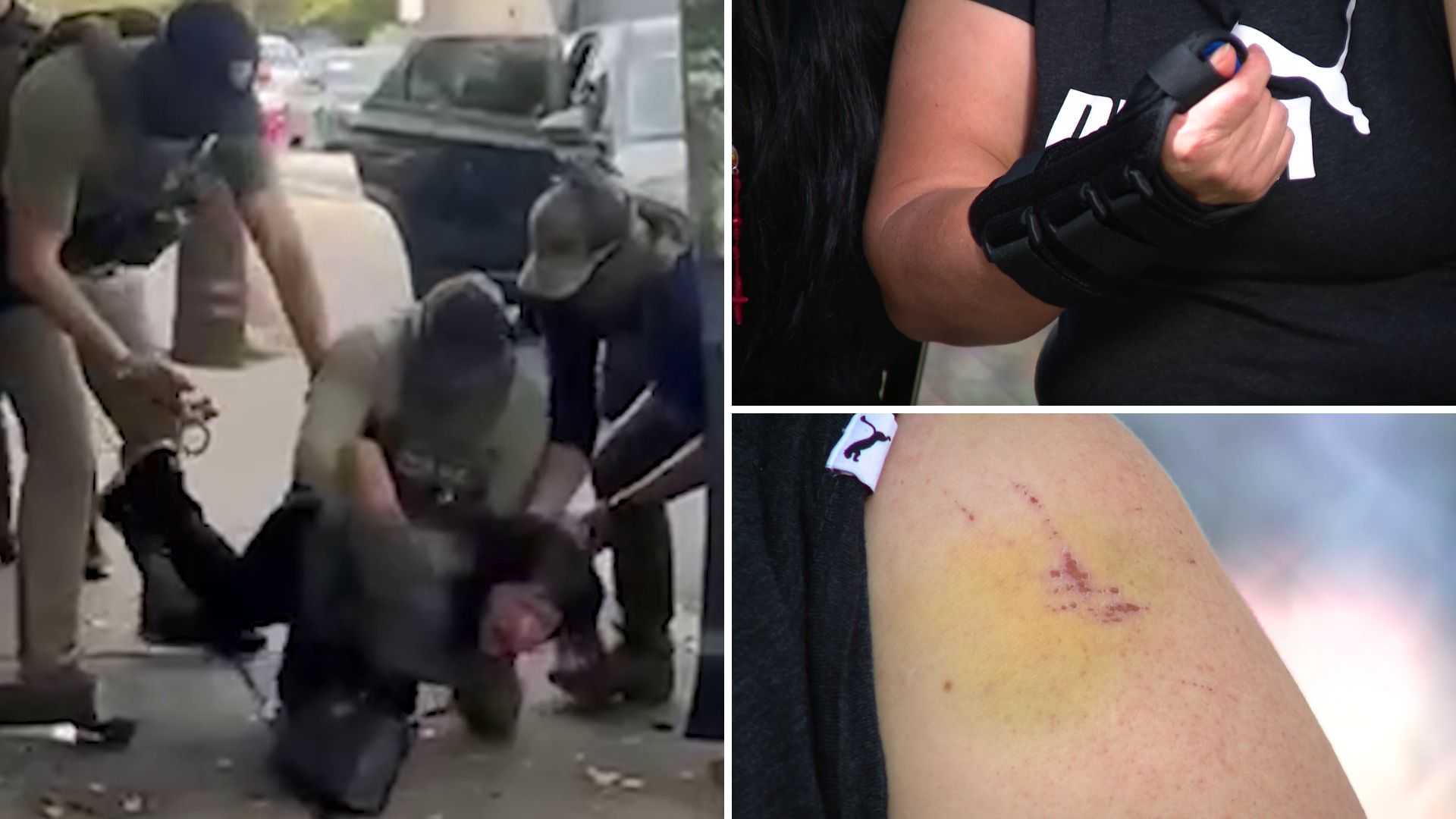 Massachusetts mother alleges ICE agents used excessive force on her in ...
