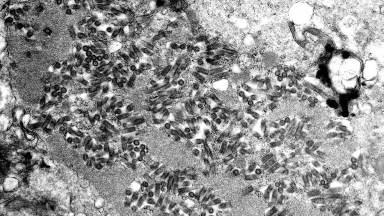 Rabies-positive bat confirmed in Kent County; health officials urge caution