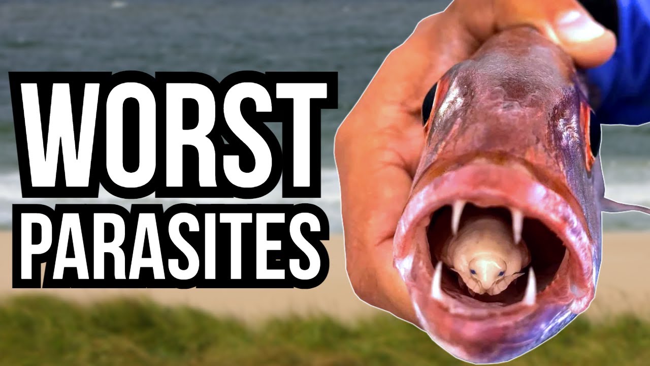 3 Parasites So Disturbing You’ll Wish You Never Knew About Them