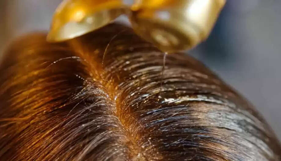 Natural Remedies for Stronger Hair Using Mustard Oil
