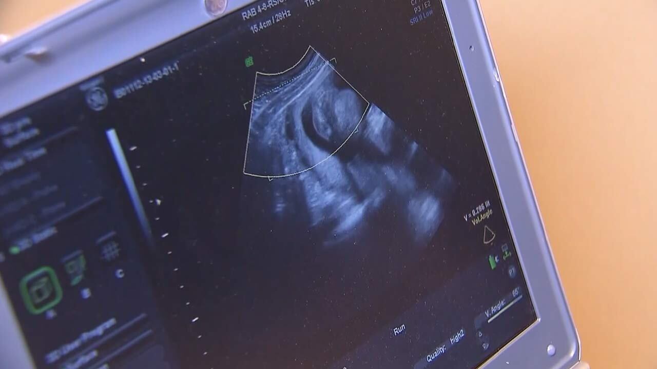 SC House panel advances bill classifying abortion medications as ...