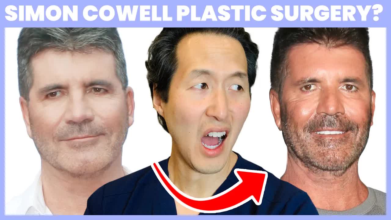 Doctor Breaks Down Simon Cowell's Changing Appearance