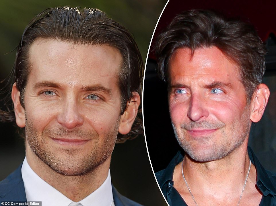 Plastic surgeons weigh in on Bradley Cooper's new look
