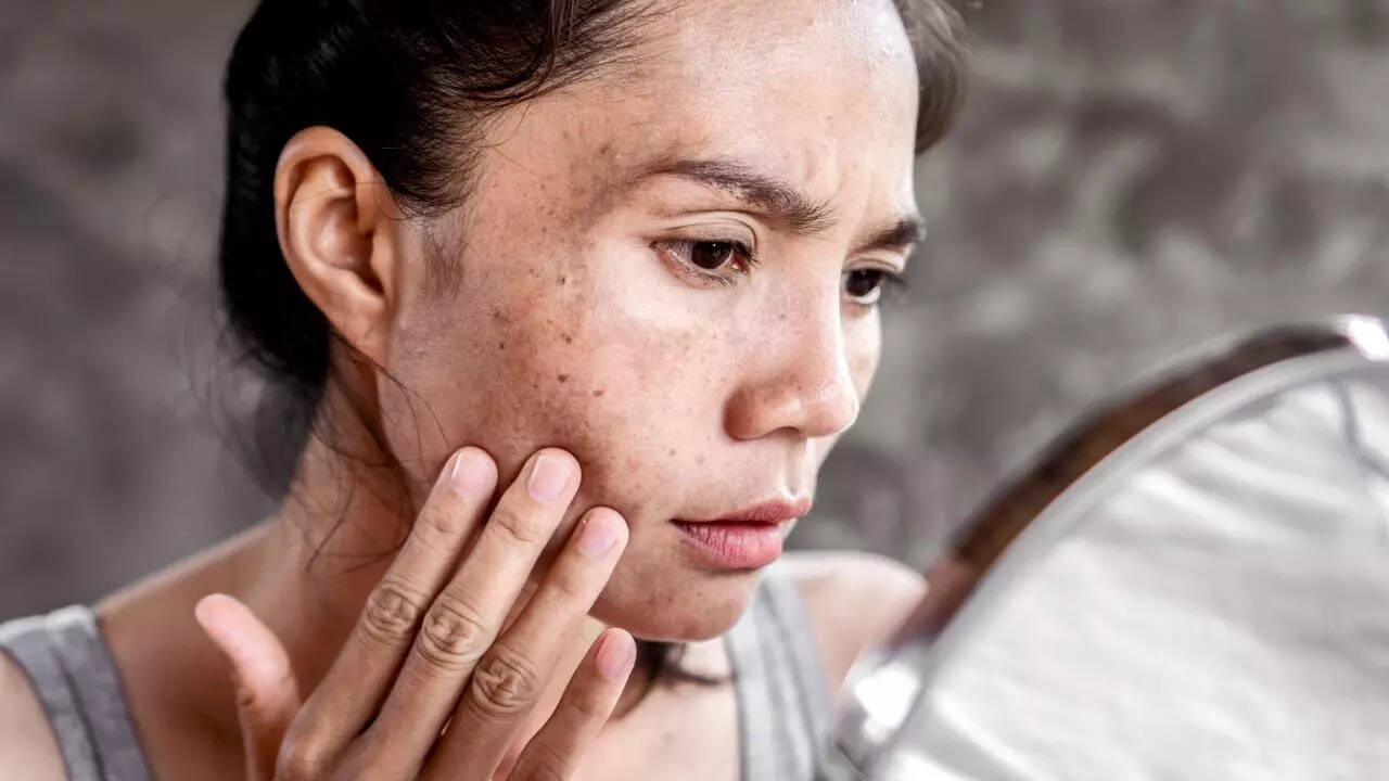 From dark neck to clubbed fingers: 5 signs of liver damage that look ...