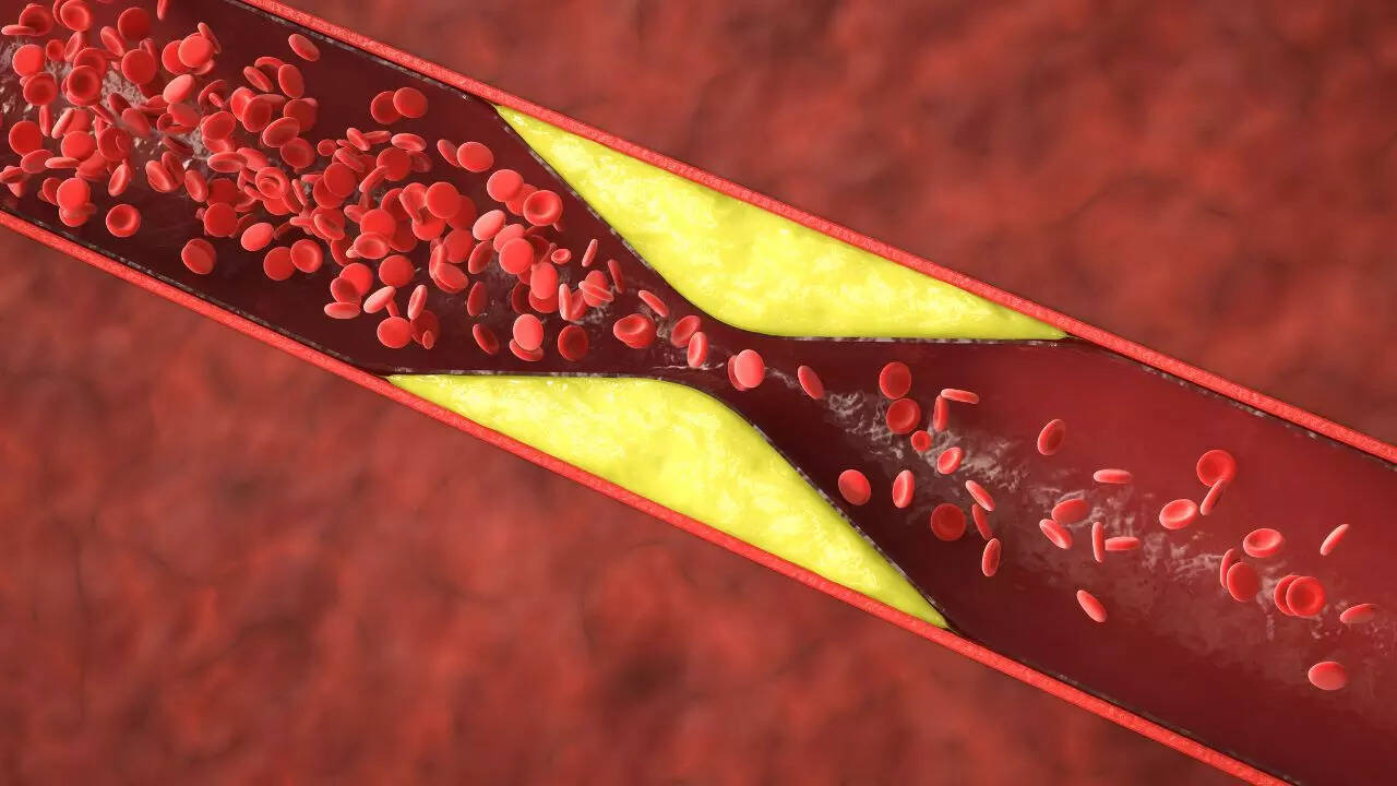 Cardiologist reveals 3 simple changes to lower cholesterol that ...