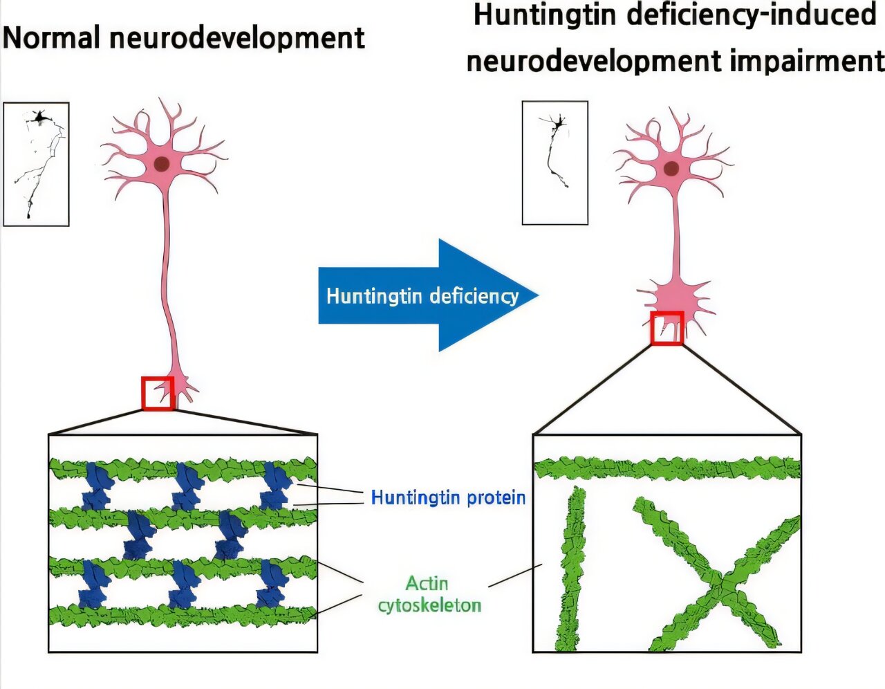 Huntingtin protein arranges cytoskeletal filaments, offering insight ...