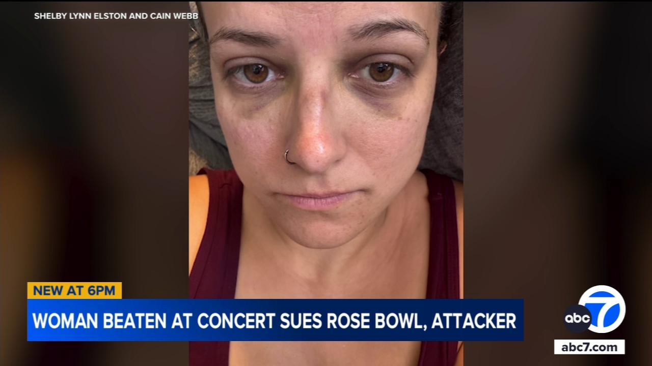 Woman beaten unconscious at Rose Bowl sues venue, suspect