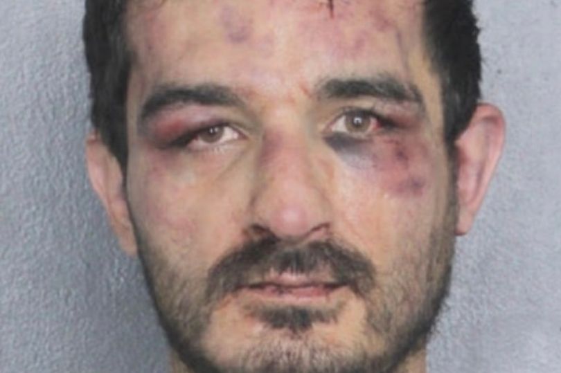 Suspected burglar left black and blue after targeting MMA fighter's home