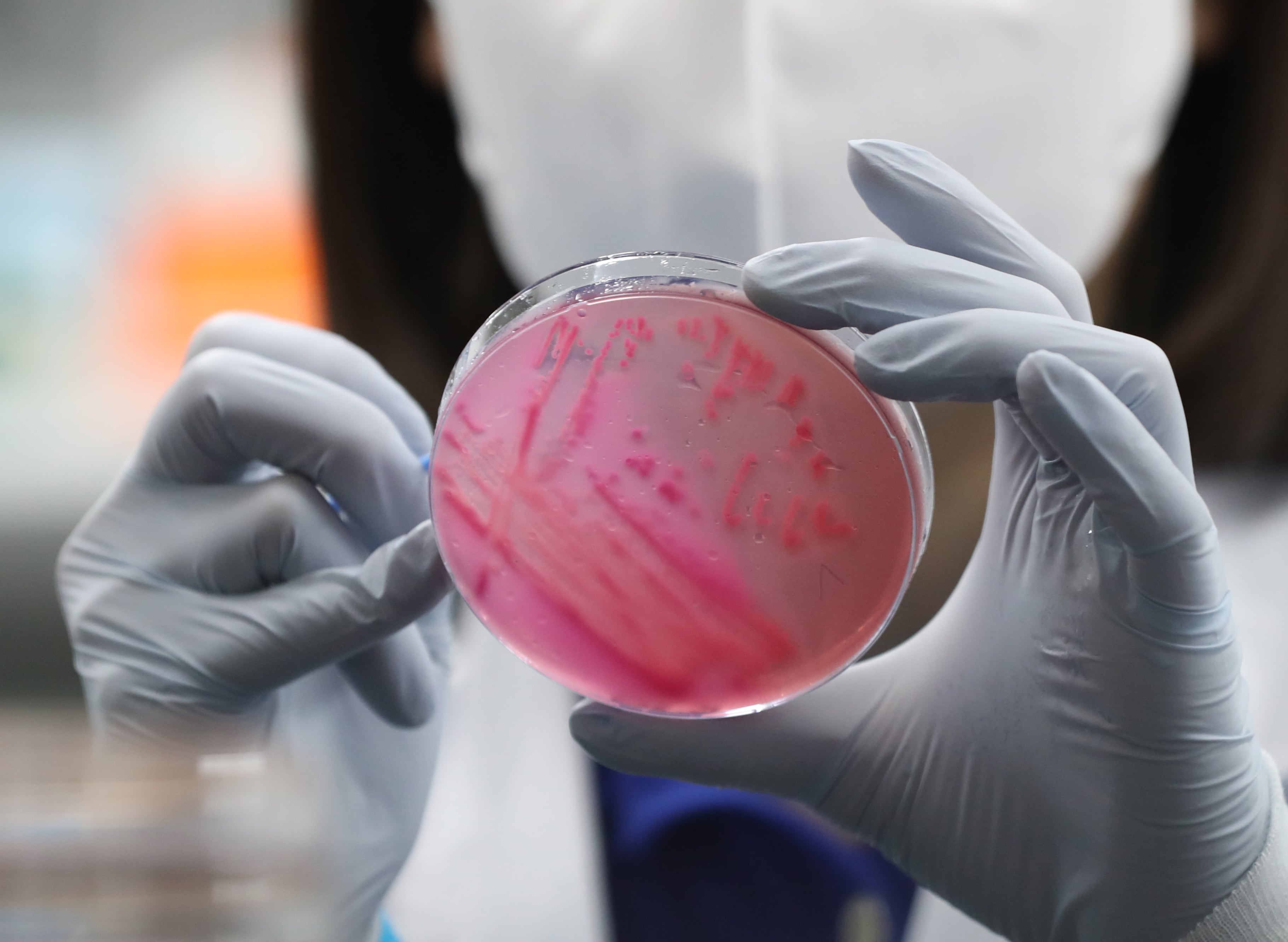 Group Food Poisoning Symptoms Reported at Jeju Elementary School