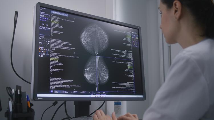 Mammograms may reveal early heart disease risks, study finds