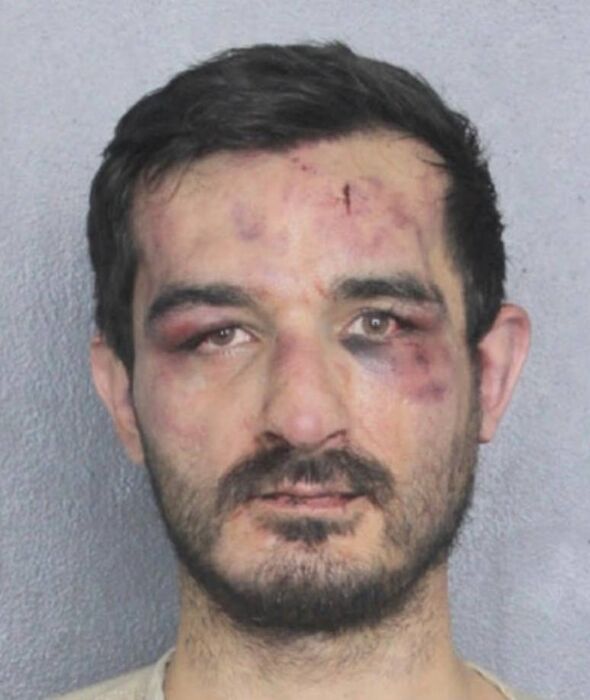 Burglar left black and blue after 'accidentally' breaking into MMA ...