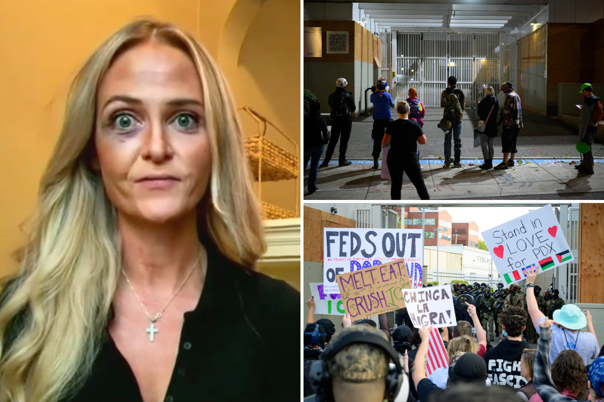 Reporter reveals black eye allegedly from Portland Antifa protester ...