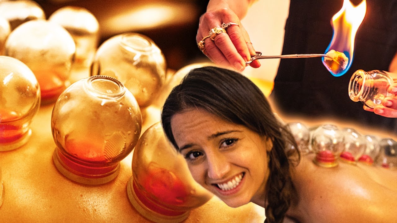 Why athletes swear by fire cupping