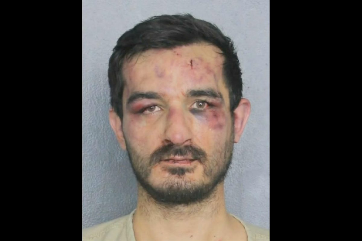Mugshot shows burglary suspect beaten black and blue after targeting ...