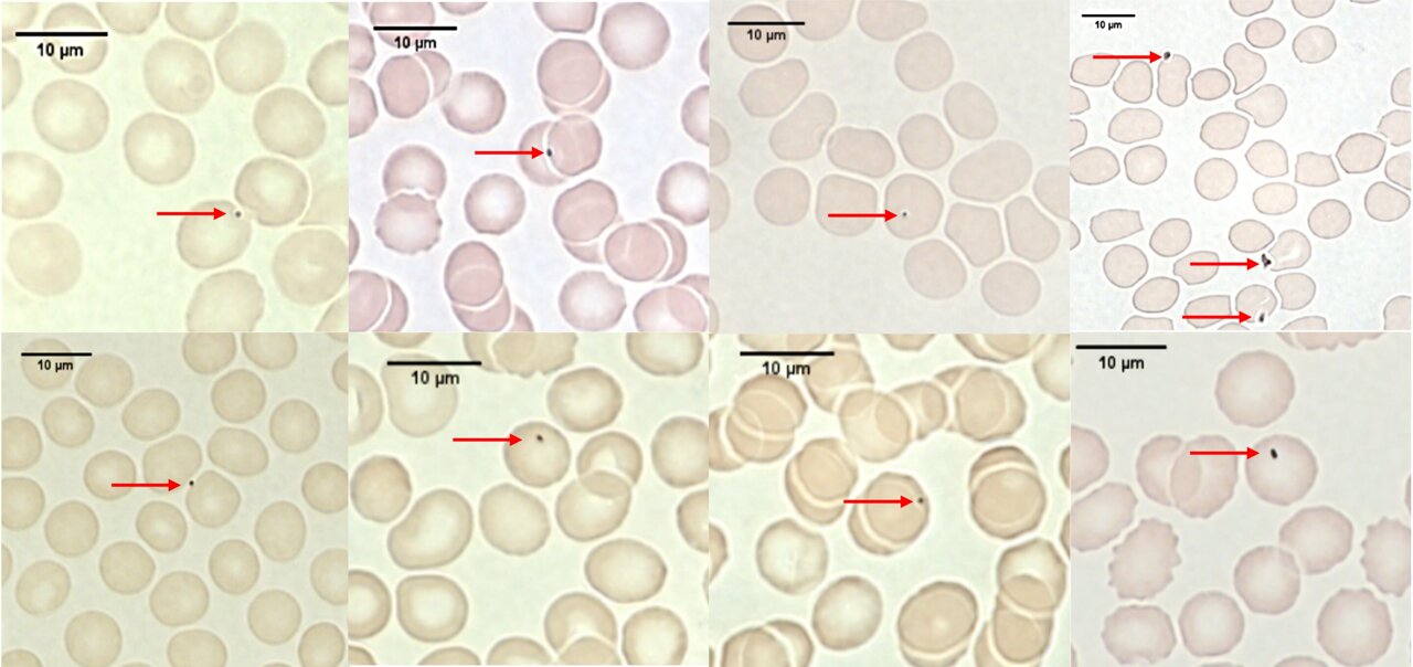 Air pollution particles discovered hitching a ride around the body on ...
