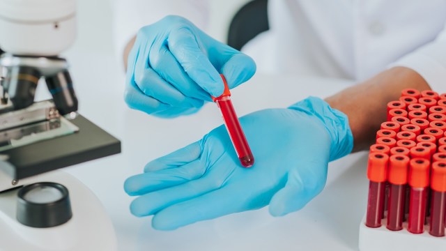 Researchers sound alarm over disturbing new finding in human blood ...