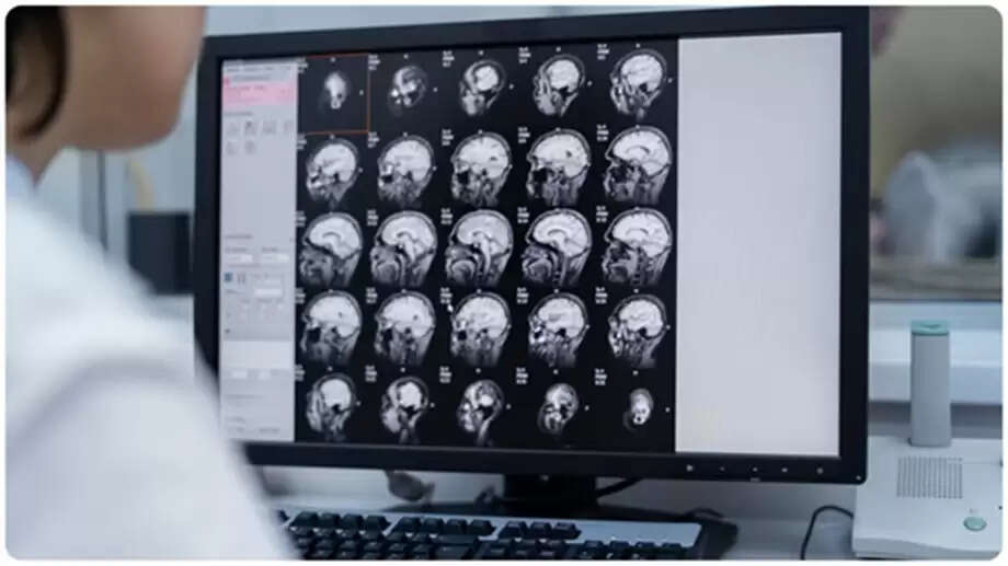 The Impact of Sleep on Brain Health: Understanding Premature Aging