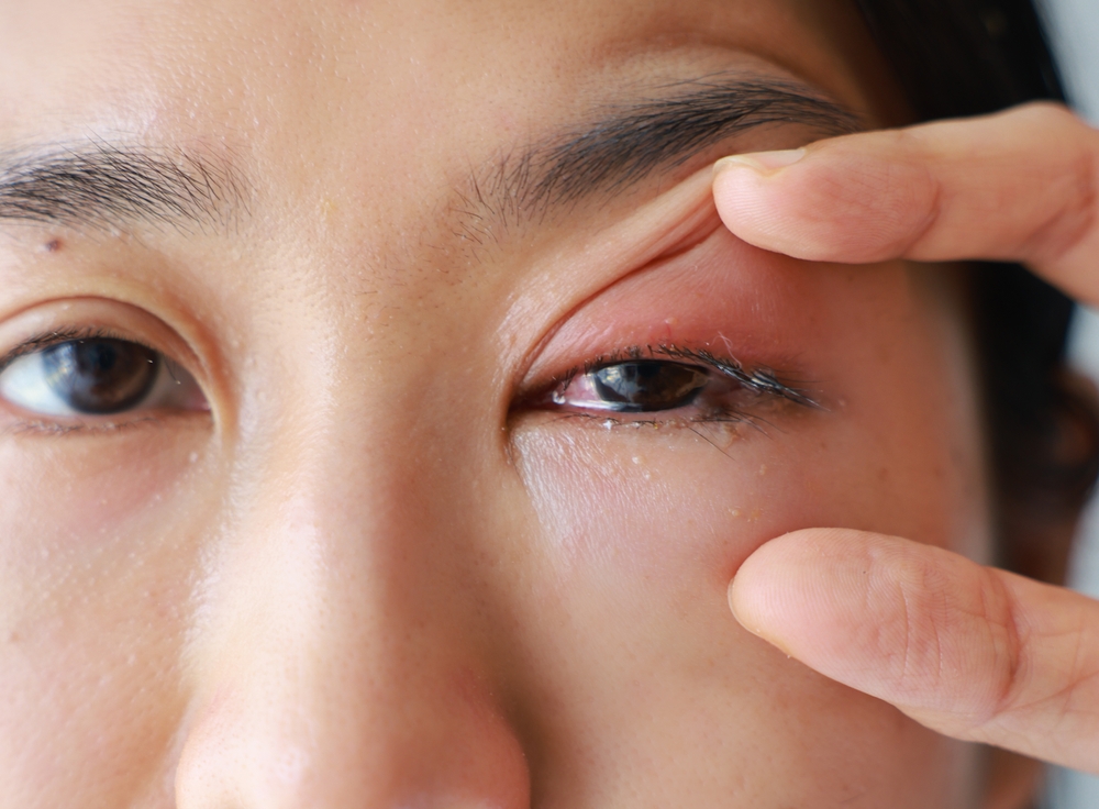 Eye Experts Reveal the Habits That Damage Your Vision