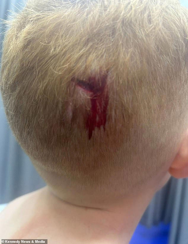 Mum forced to pay £1,500 when son's holiday backflip goes wrong