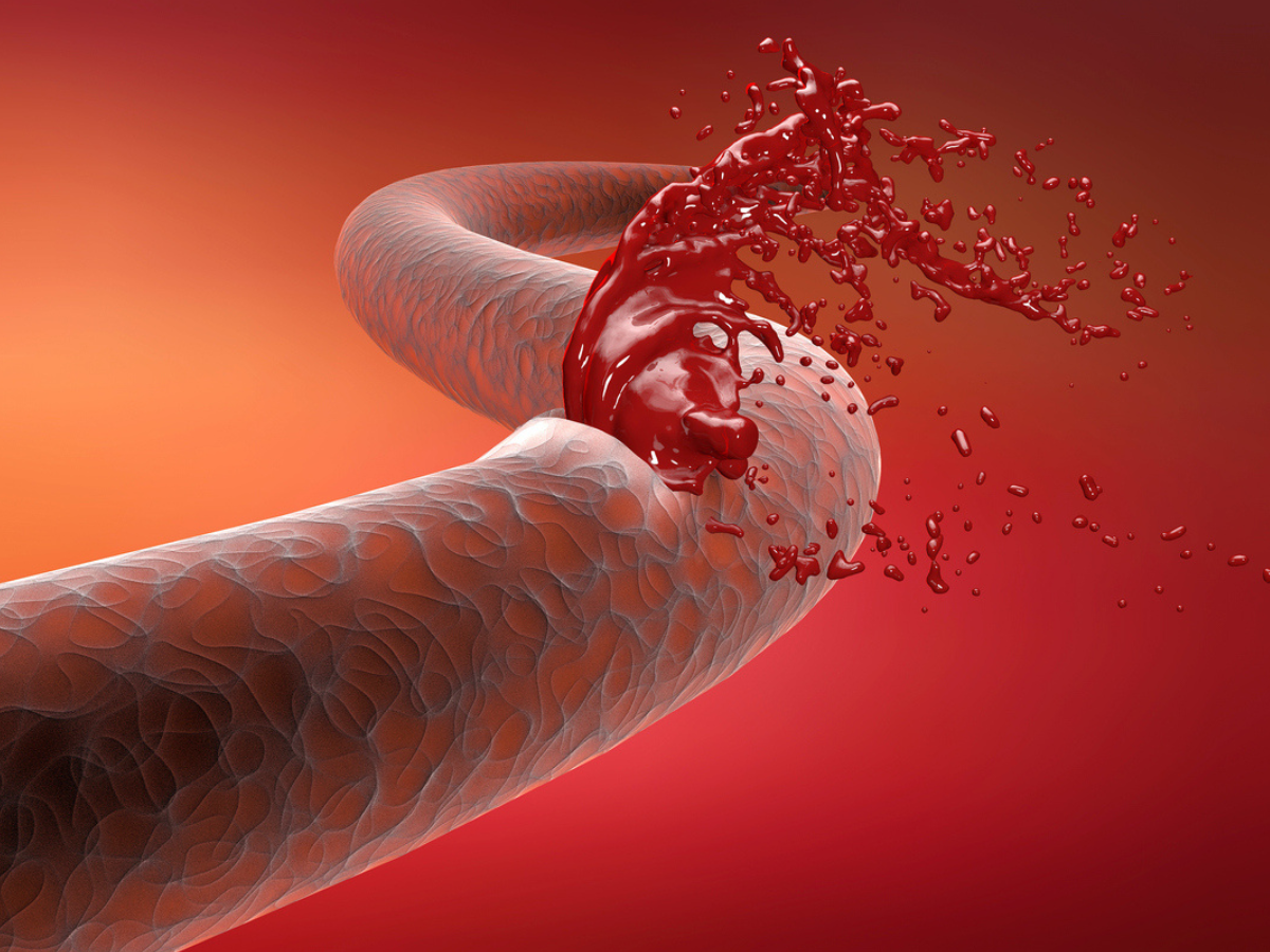 7 hidden causes of heart attacks—and signs to spot in women under 65