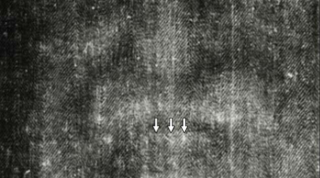 Shroud of Turin mystery deepens as surgeon spots hidden detail that ...