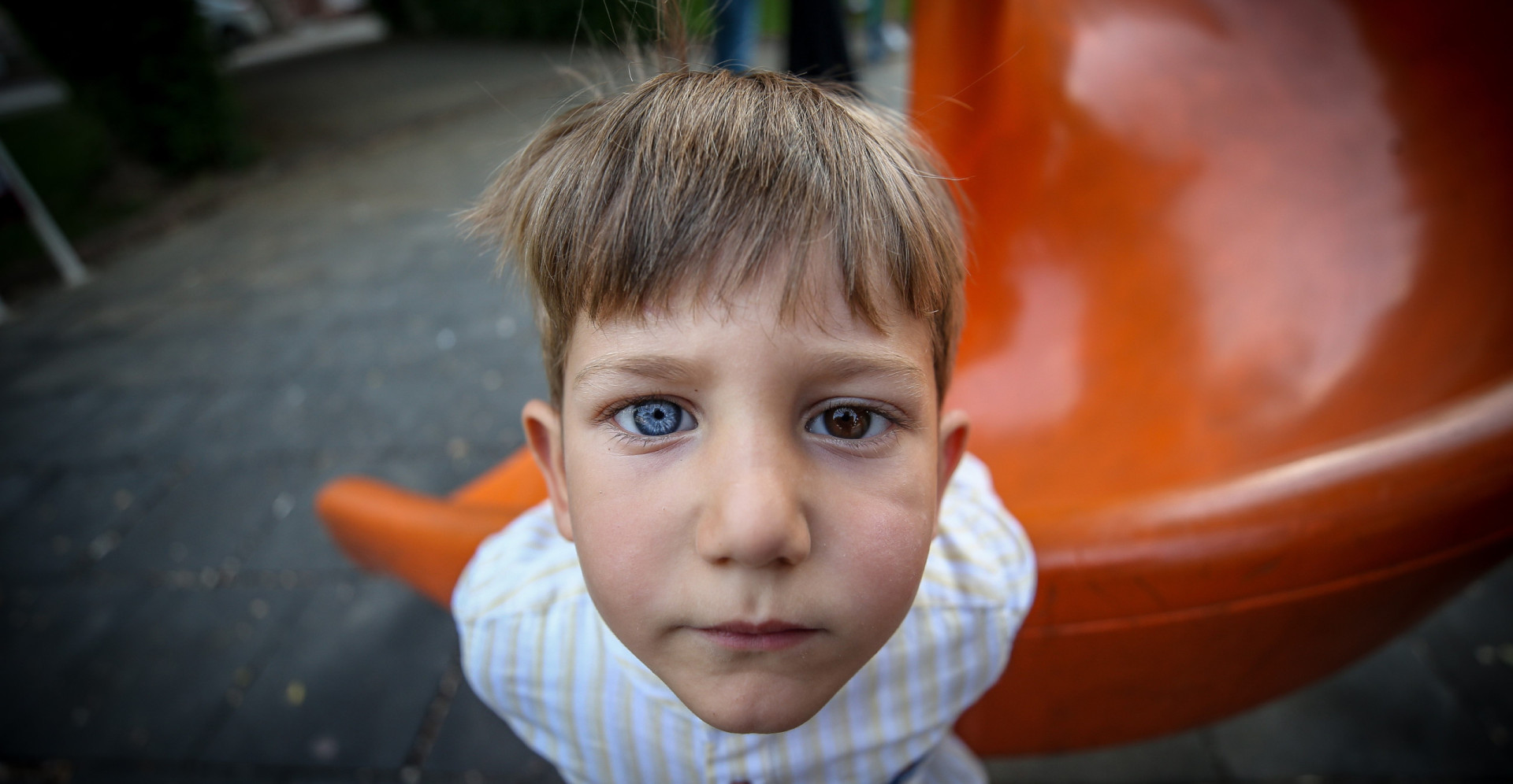 Rare Human Body Features You Didn T Know Exist