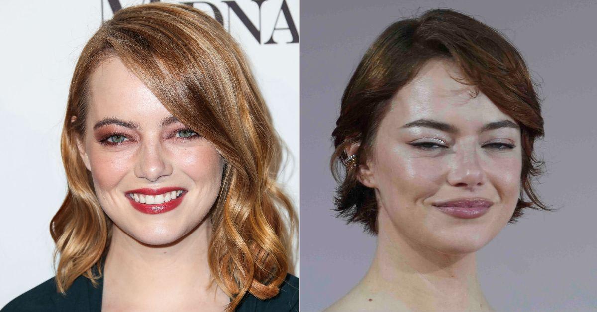 Emma Stone's 'Scary' New Look Is a Result of an Eyelid and Face Lift ...