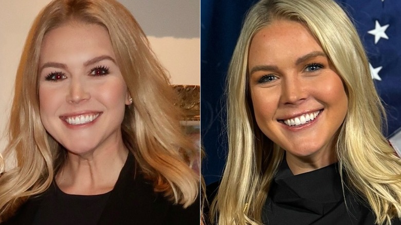 Karoline Leavitt's Real Skin Tone Is Blinding Under All That Bronzer