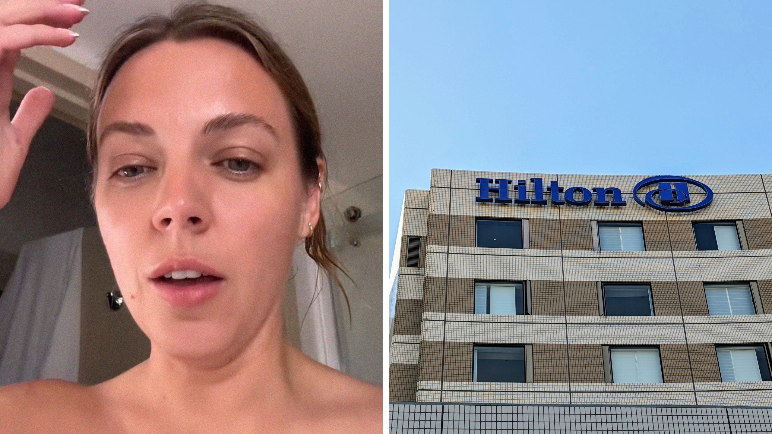 ‘This was the color of my bathing suit‘: Woman stays at Hilton Garden ...