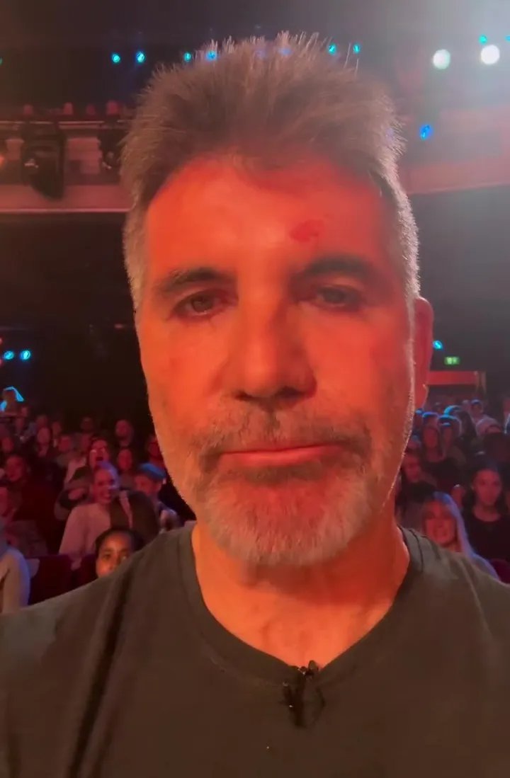 Simon Cowell skips BGT after shocking head injury